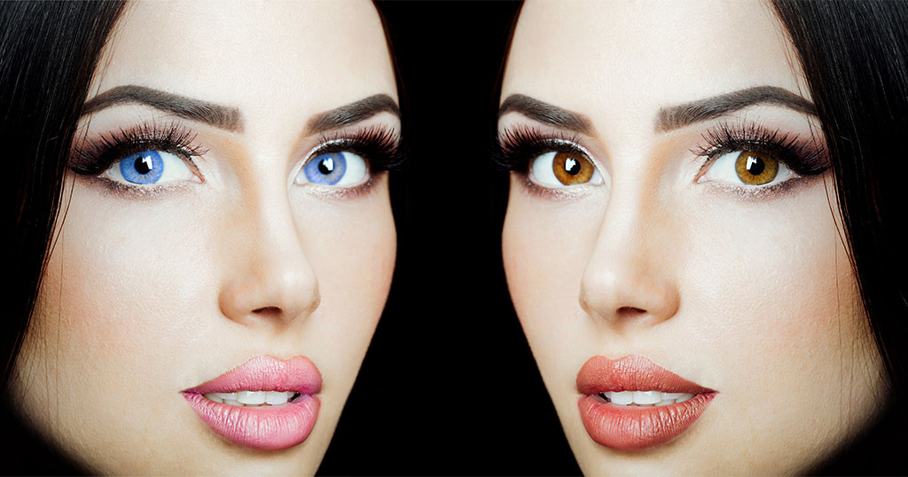 What Happens Before & After Eye Color Surgery? Here’s What to Expect ...